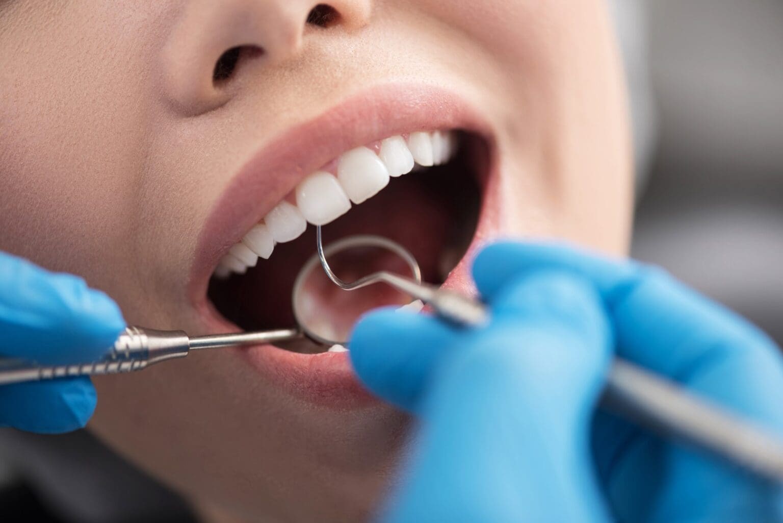What Are The 3 Main Types of Cavities? | Enamel Dental Centre