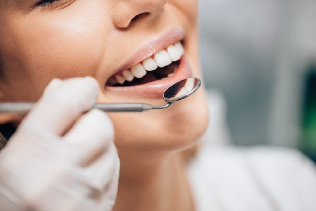 How Long Does It Take to Fix a Cavity? | Enamel Dental Centre